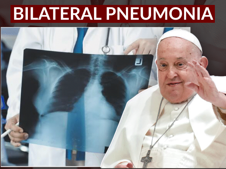 Pope Francis was suffering from bilateral pneumonia | Bhaskar English