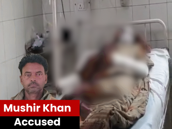 Brother In Law Throws Acid On Widowed Sister In Law Accused Wants To