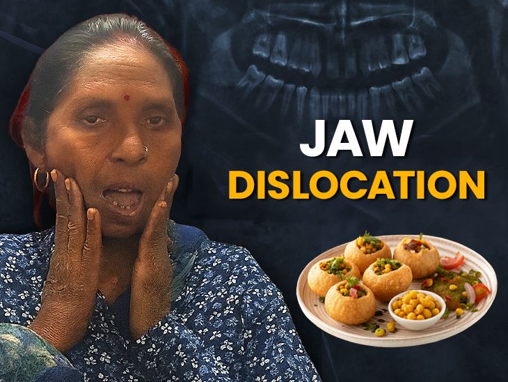 Woman jaw dislocated after eating Golgappa in UP