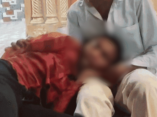 Mirzapur Boy Barking After Dog Bite; Temple Visit to Hospital