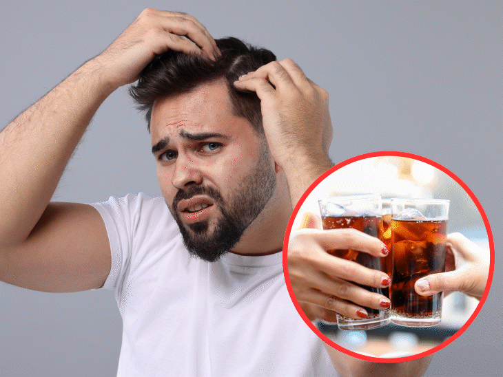 Soft Drink Hair Loss Side Effects; Sugary Sodas Vs Baldness | Nutrient ...