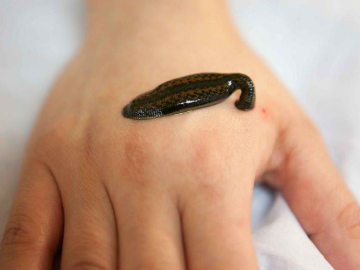 In a decade, treatment of leech was expensive up to 13 times | एक दशक ...