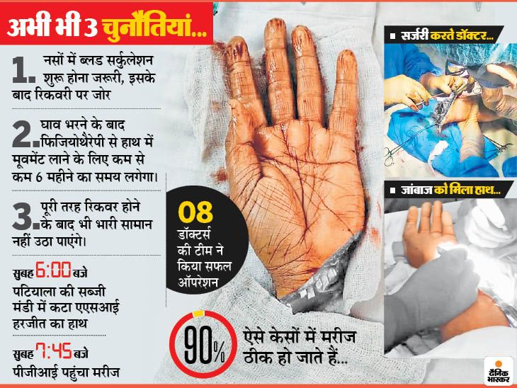 Team of PGI doctors adding ASI's severed hand after 7 and a half hours ...