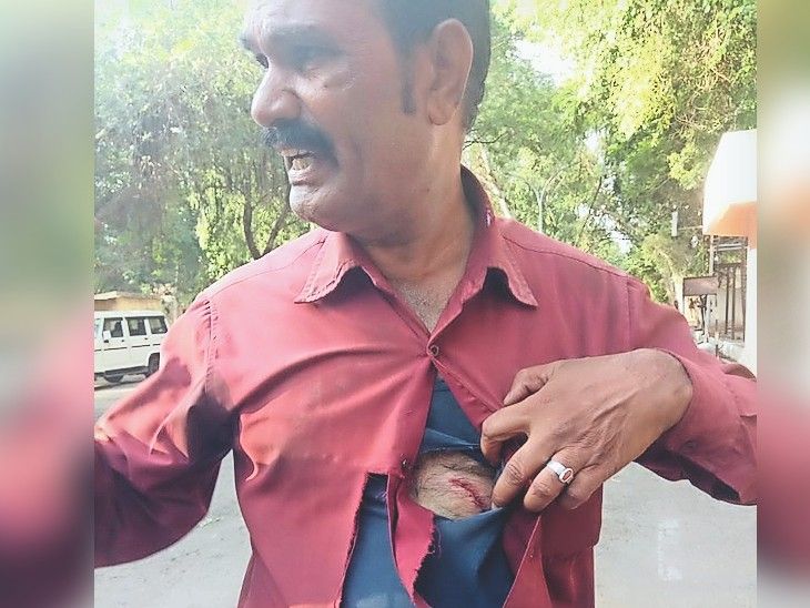 The bear attacked the supervisor in thermal, did not lose courage ...