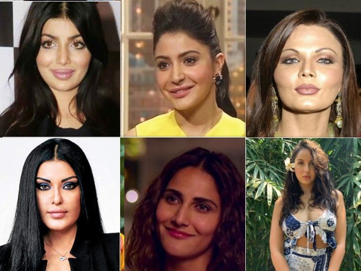 South actress Reeja Wilson's face destroid after facial surgery, these ...