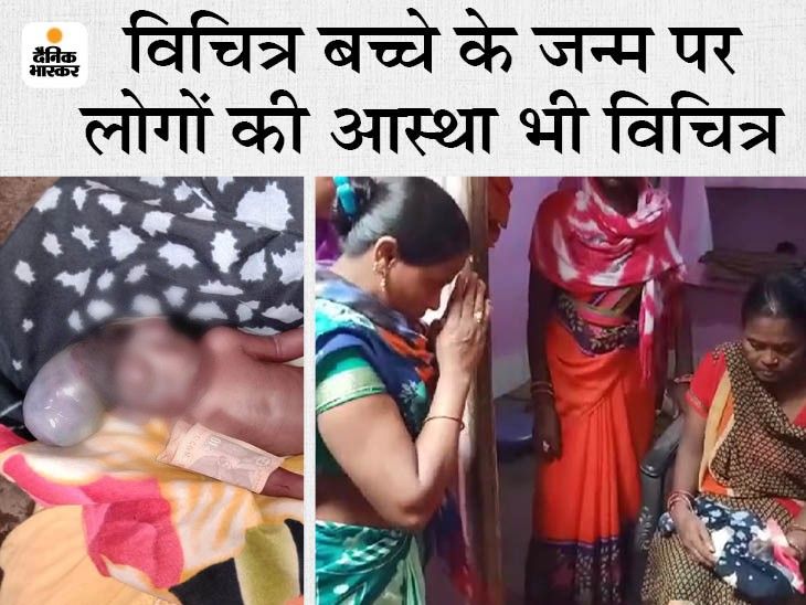 Half head developed child born in Nalanda people started worshiping