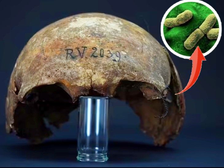 Meet Europes oldest plague victim Earliest strain of the bacteria ...