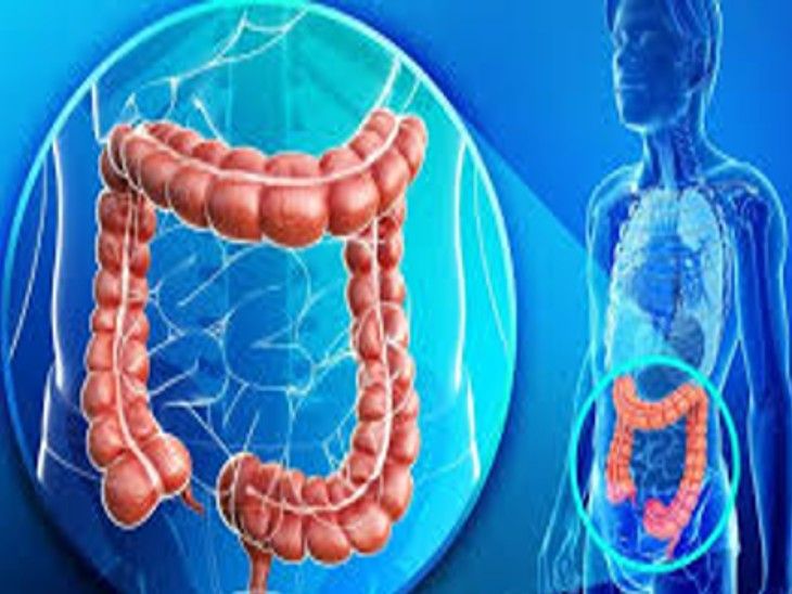 Open surgery of tumor in the large intestine in government hospital ...