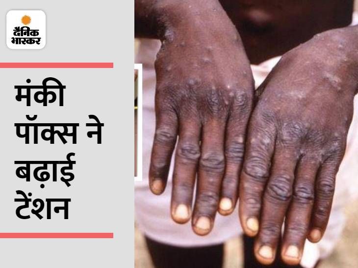 Wards made in SN Medical College and Health Center, Barauli Ahir | मंकी ...