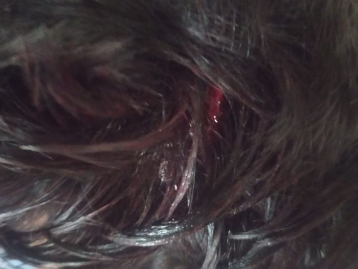 ABVP-SFI activists clash in Kotshera College