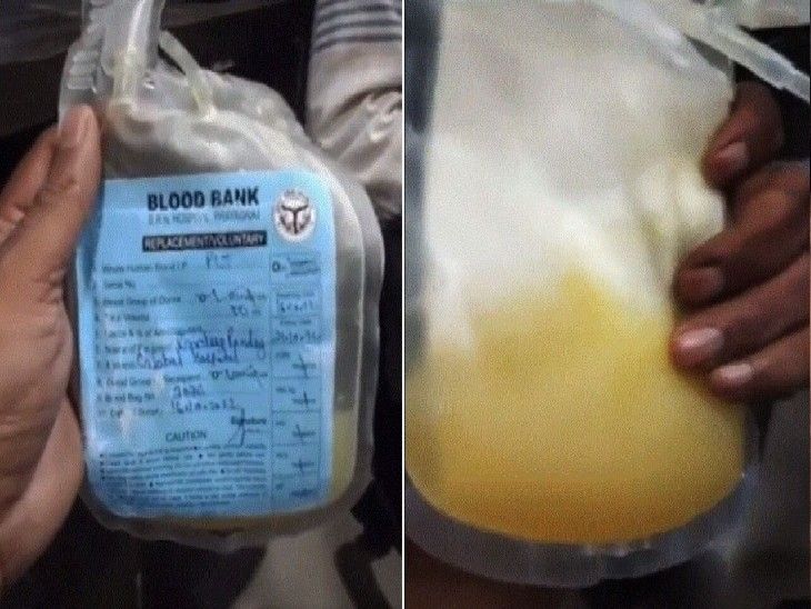 Update on the issue of offering juice instead of platelets: SRN will ...