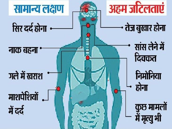 80% of children reaching hospital in Dhanbad suffer from viral ...