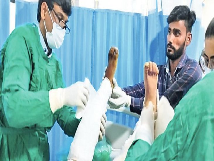 The pain of scorched people will reduce up to 70%, recovery is also ...