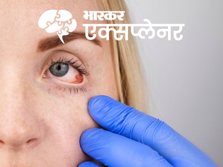 India Eyedrop Controversy Explained: US Blindness and Infection Cases ...