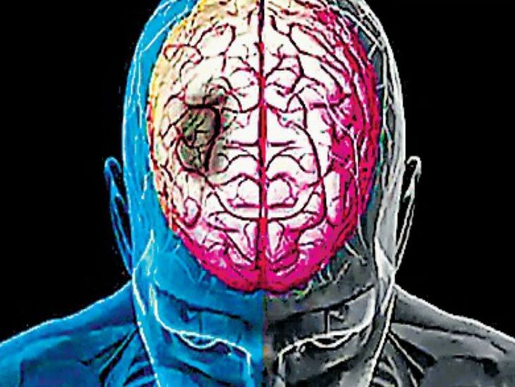 Got 12 surgeries done in 8 years, but got cured after coming to AIIMS ...