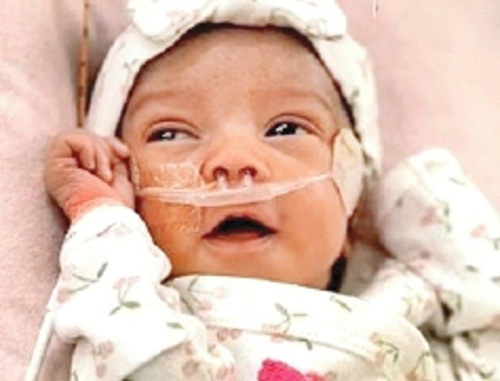 US Baby Brain Surgery In Womb | All You Need To Know