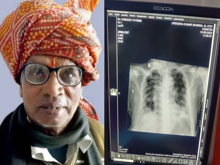 Hospital said- no facts of instrument being found in X-ray, family's ...