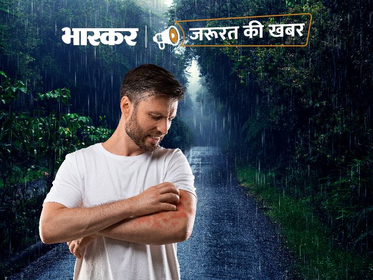 Monsoon Skin Allergies Types; Rainy Season Common Skin Problems And ...