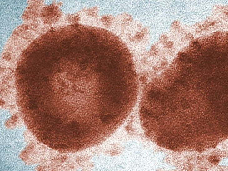Pandemics Early Warning AI System (EWAD) Details | SARS-CoV-2