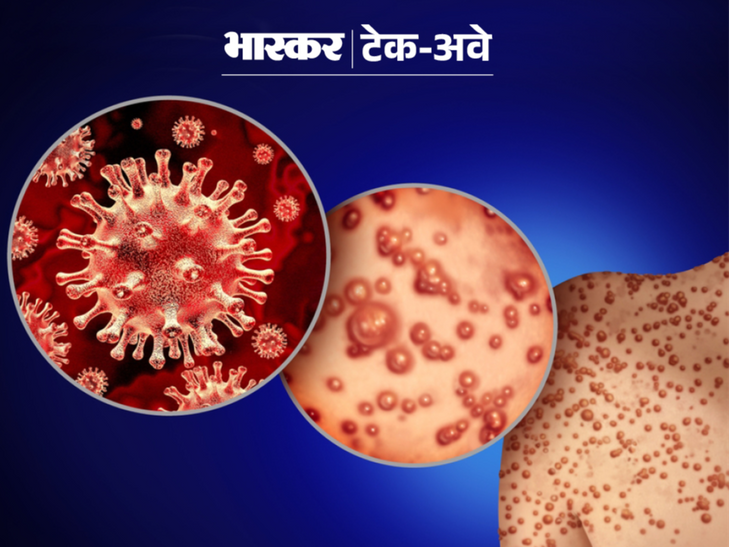Chickenpox virus becomes active after 50 years