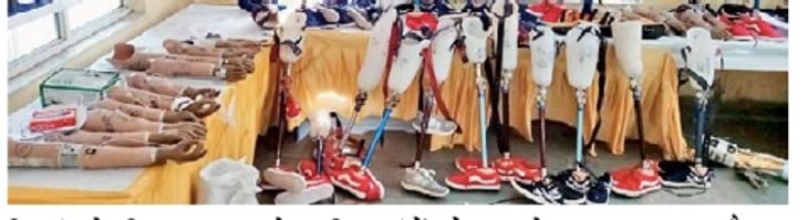 Free artificial limbs will be fitted to disabled people knowingly or ...