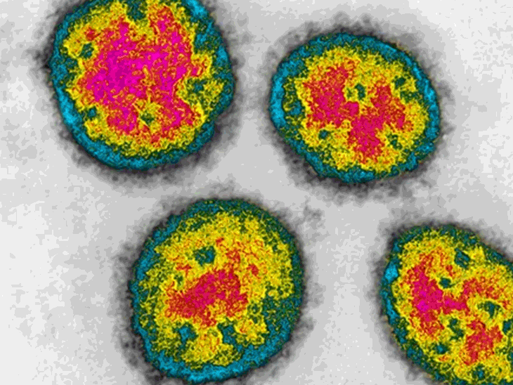 Karnataka Monkey Fever; Kyasanur Forest Disease Symptoms Explained ...