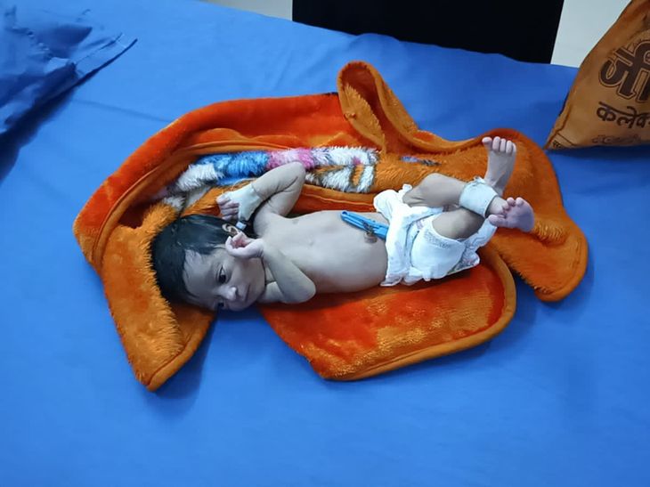 Newborn's leg turned black due to injection | इंजेक्शन लगाने से नवजात ...