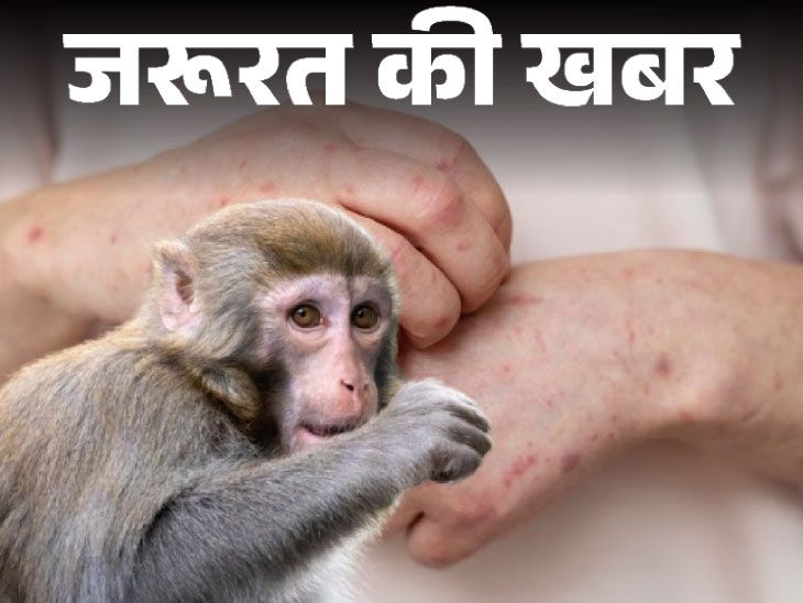 Karnataka Monkey Fever Symptoms Explained; Dangers, and Prevention ...
