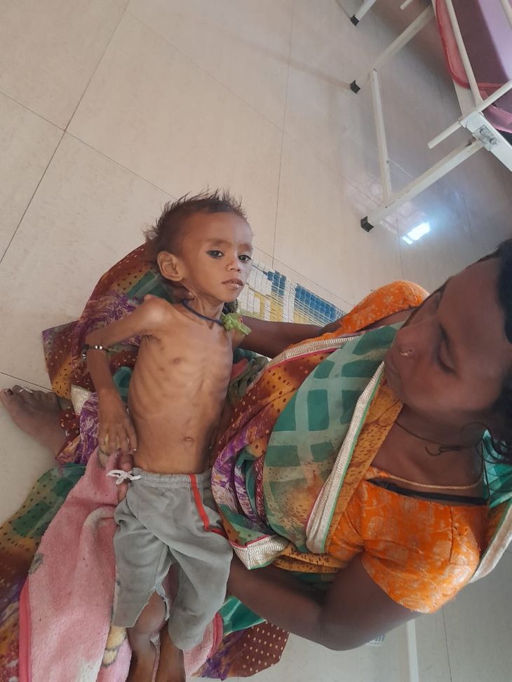 Panna: Child battling death, only one gram of hemoglobin left in his ...