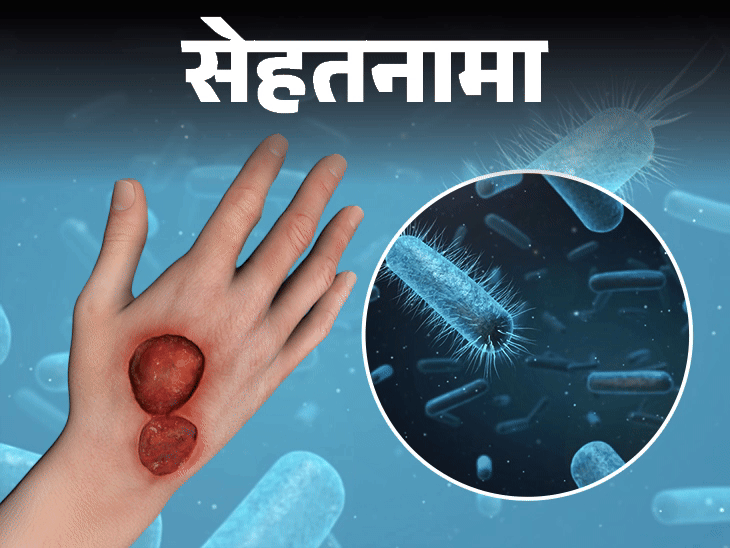 Japan Flesh-Eating Bacteria; How It Spreads? STSS Syndrome Symptoms ...