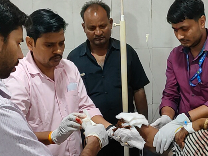 A young man's hand got cut off when a bracelet got entangled in a ...