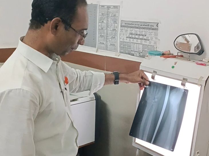 Manual X-rays are being taken out in Civil Hospital | डिजिटल एक्सरे ...