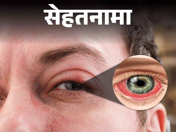 Eye Infection; Trachoma Symptoms Treatment And Prevention Tips