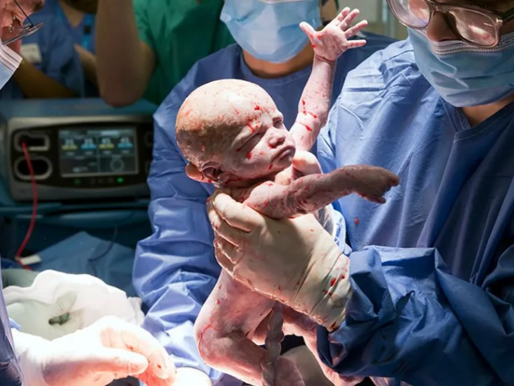 UK Womb Transplant Child Birth Case; Grace Davidson | Sister Amy ...