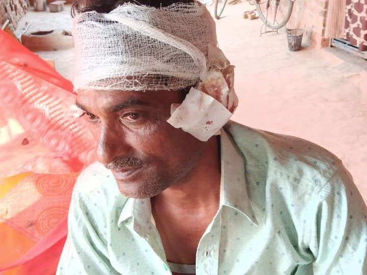 Terror of monkey in Pisawa | पिसावा में लंगूर का आतंक: बच्चों को बचाने ...