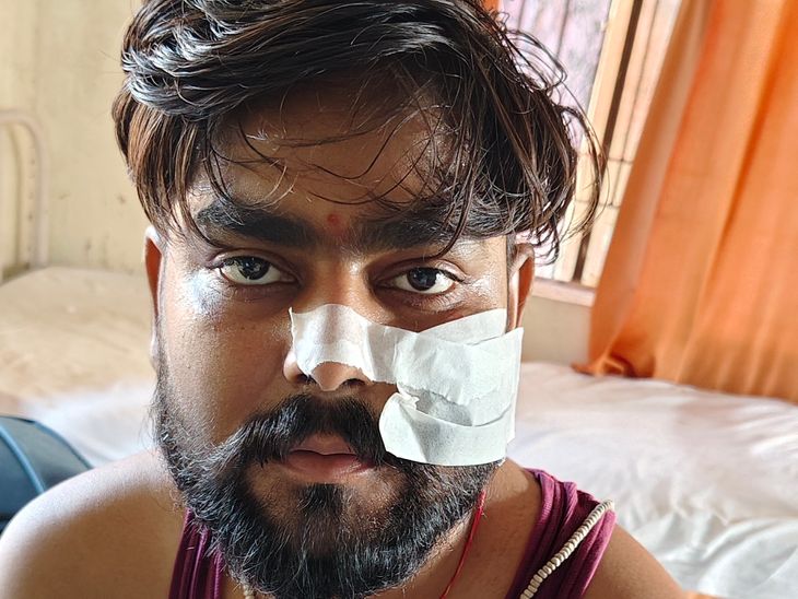 Car-bike collision in Bilgram | बिलग्राम में कार-बाइक की टक्कर: परसोला ...