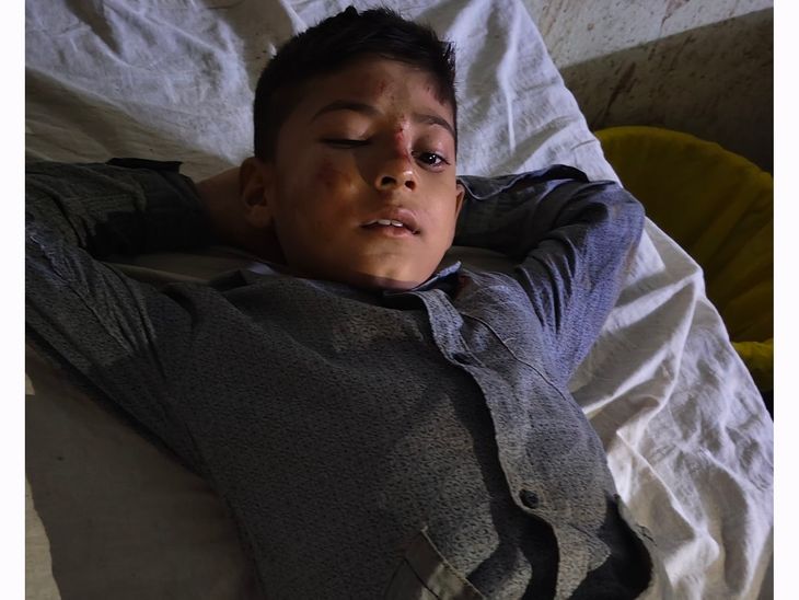 Two bikes collided in Bilgram | बिलग्राम में दो बाइक की टक्कर: चार लोग ...