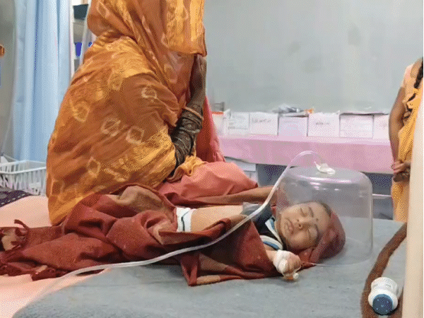 3 innocent children suffering from pneumonia were burnt with hot iron rods.