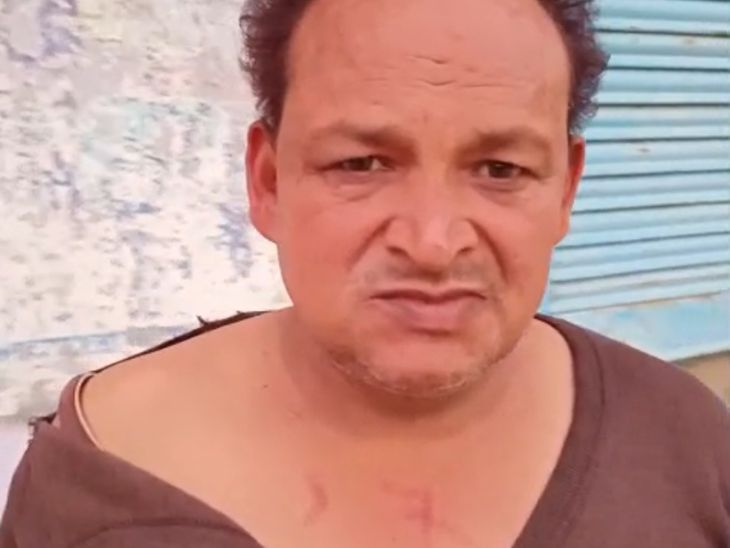 Bakery operator beaten up in Konch | कोंच में बेकरी संचालक से मारपीट ...