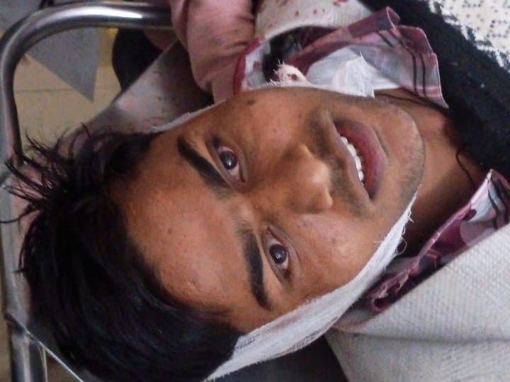 Attack on complaint of mouldy sweets