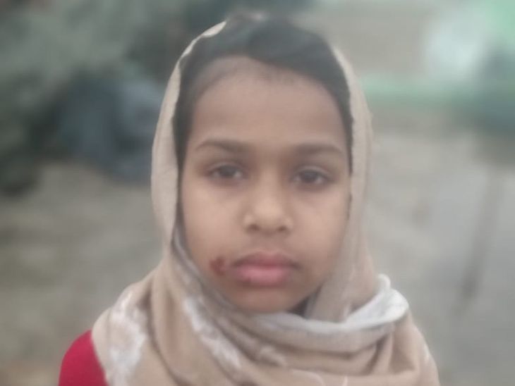 Pootha Village Stray Dog Attack: Residents Demand Action After 3 Injured