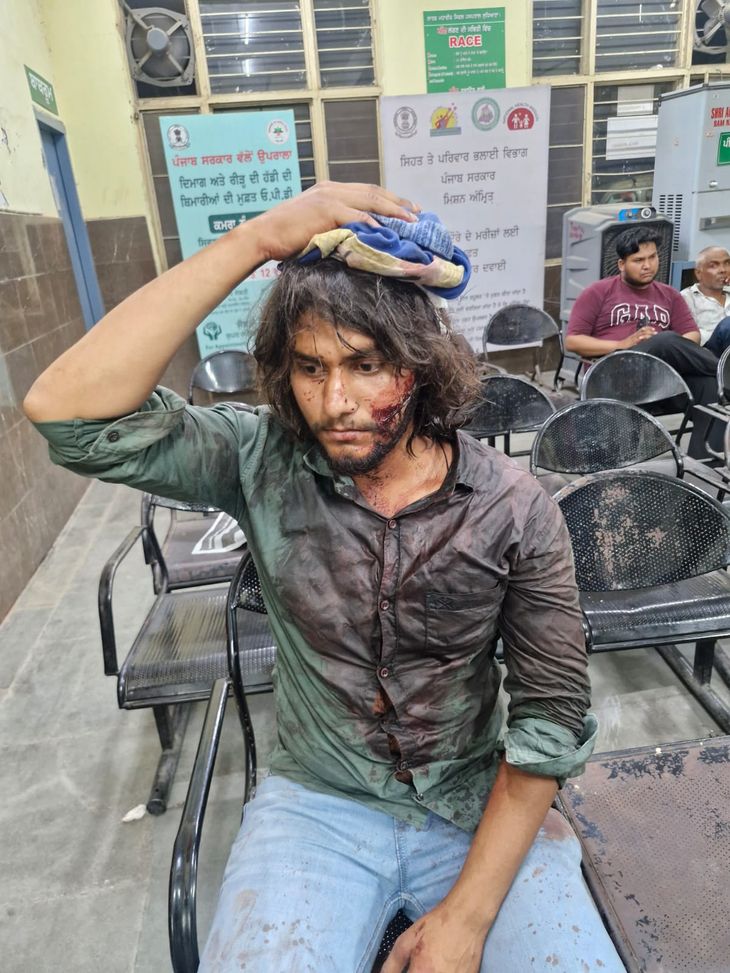 Attack with sharp weapons, four injured