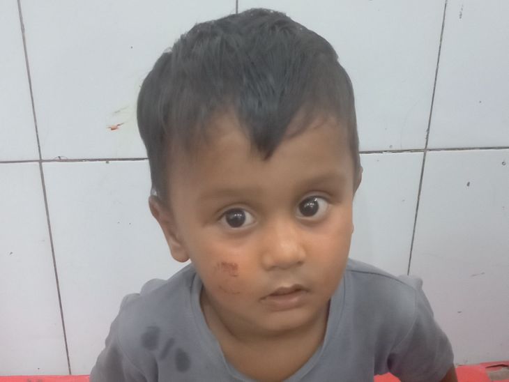 Shahabad Kheda Village Jackal Attack | Child Injured, CHC Treatment