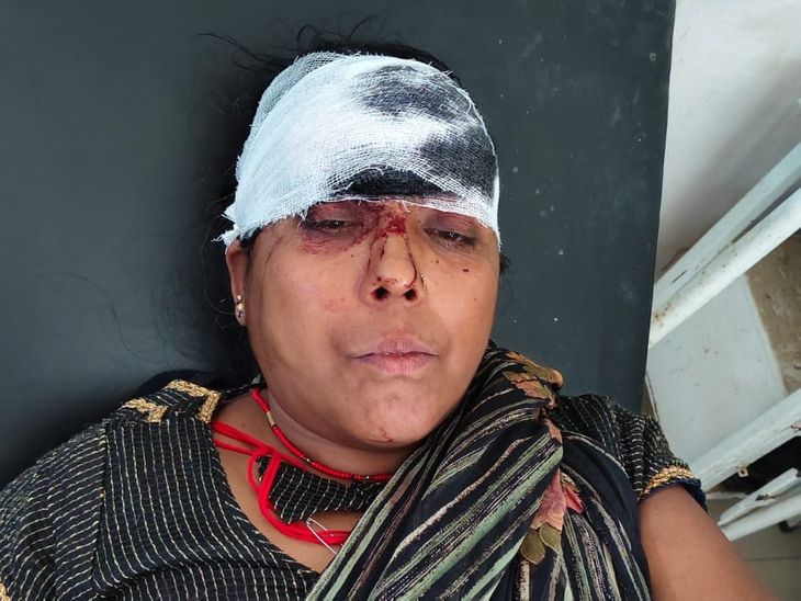 Sikri Ganj Tempo Accident | Woman Critically Ghayal Refers To District ...
