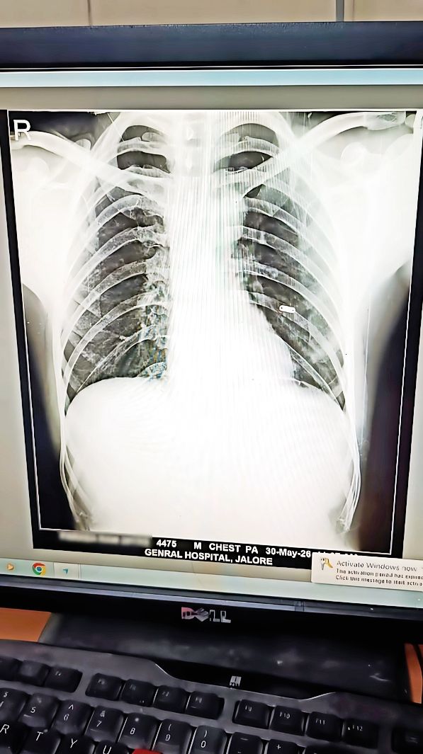 The district hospital and trauma center have run out of X-ray film for ...