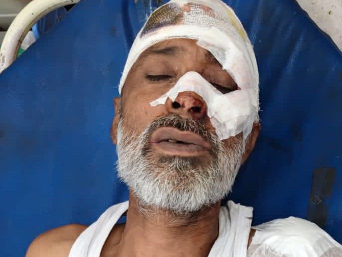 Khatauli Accident: Bike Rider Critical, Referred to Higher Center ...