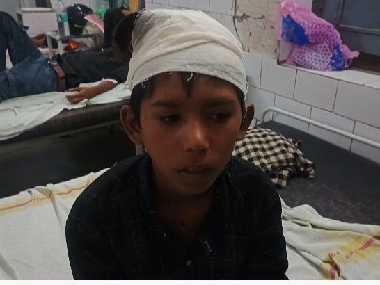 Panna Monkey Attack | Boy Severely Injured Head