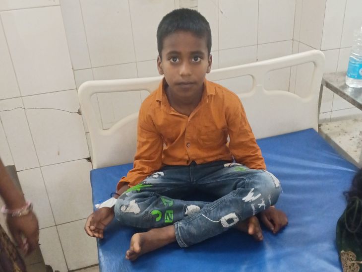 Kushinagar Boy Snake Bite | Khet Shauch Hospital Treatment