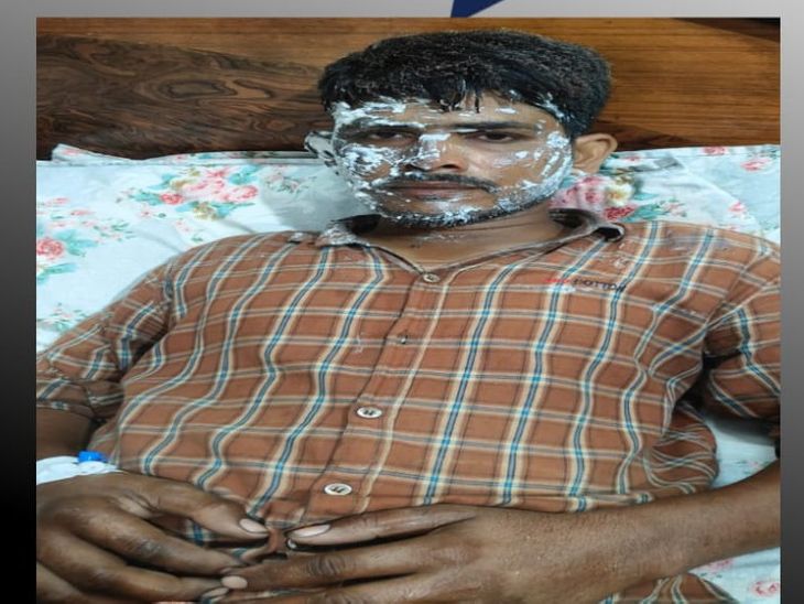Budayun Bijlighar Accident: Mechanic Mohammad Riaz Suffers Severe Burn ...