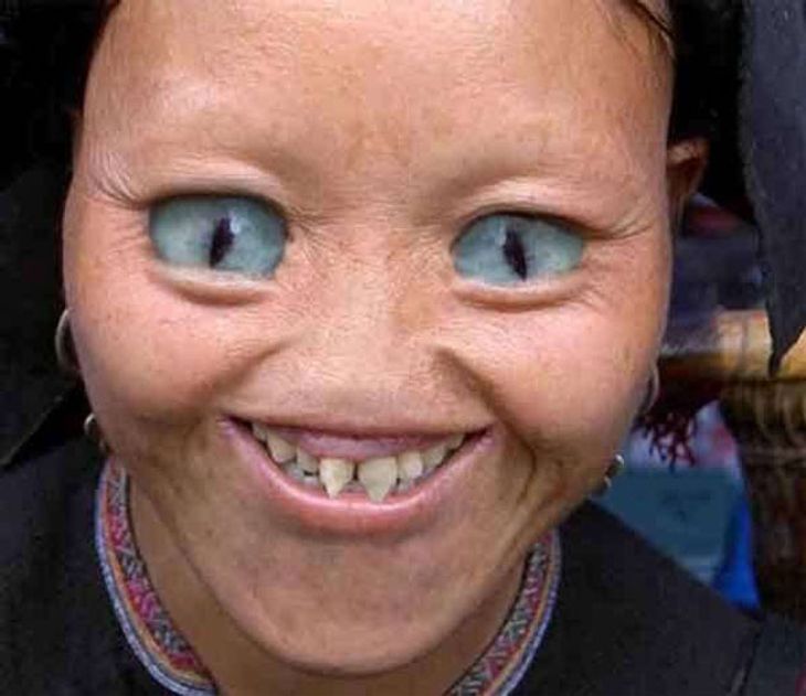 9 Most Ugly People In The World In Photos